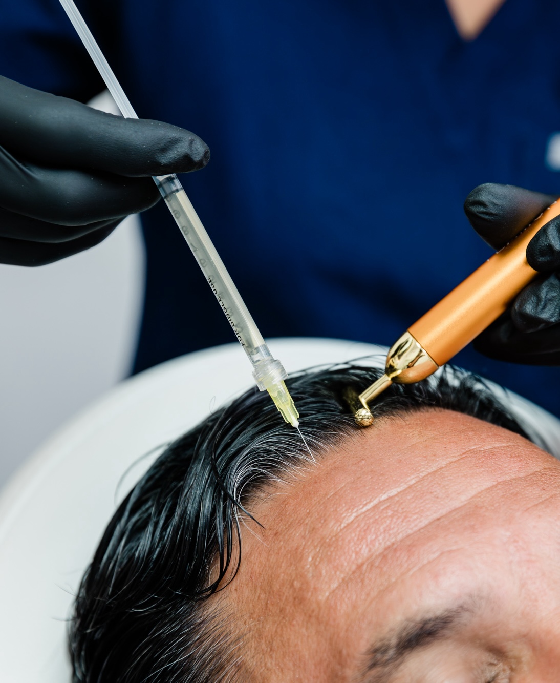 PRP Treatments | Midtowne Wellness and Aesthetics